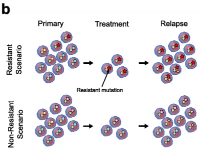 Our study about relapse of T-cell acute lymphoblastic leukemia (T-ALL ...